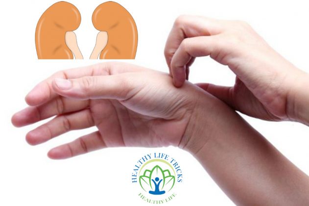 IF YOU NOTICE ANY OF THESE SYMPTOMS, CHECK YOUR KIDNEYS IMMEDIATELY