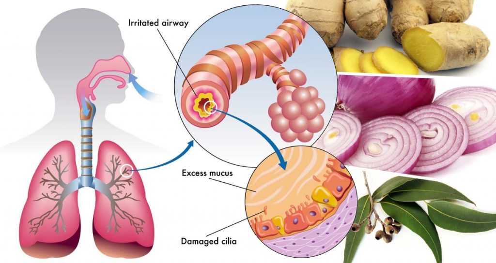 Household Solutions That You Can Use to Treat Bronchitis