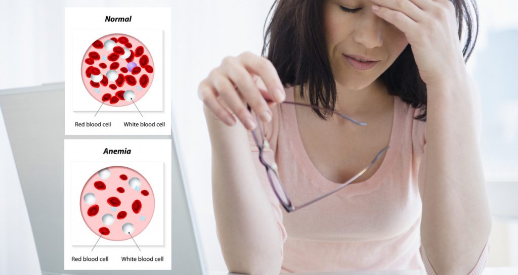 Learn About the Different Types of Anemia