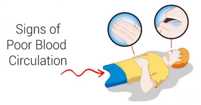 5 Warning Signs of Poor Blood Circulation